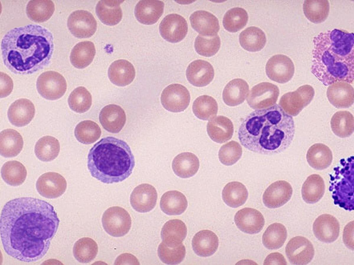 Total Leukocyte Count (TLC): Methods and Reference Ranges