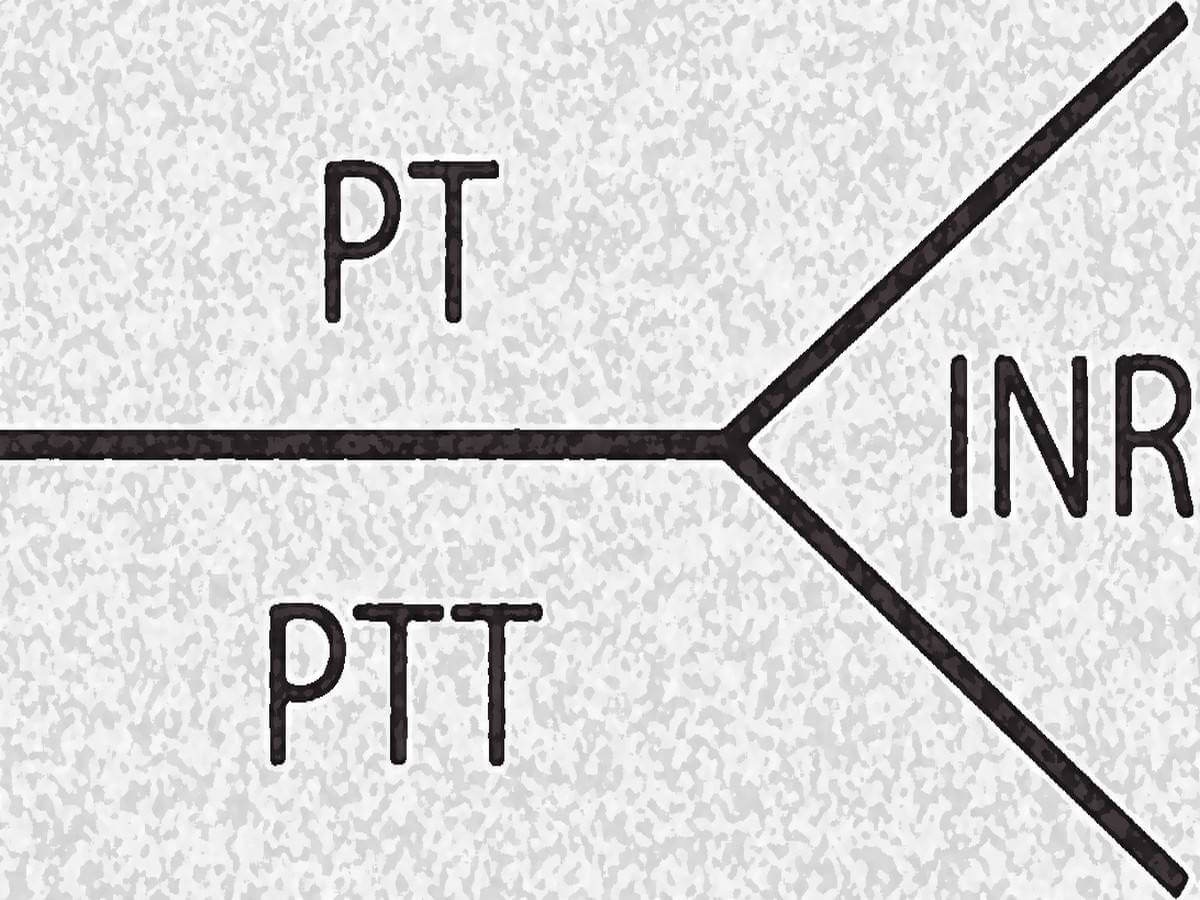 Activated Partial Thromboplastin Time (APTT), Partial Thromboplastin ...