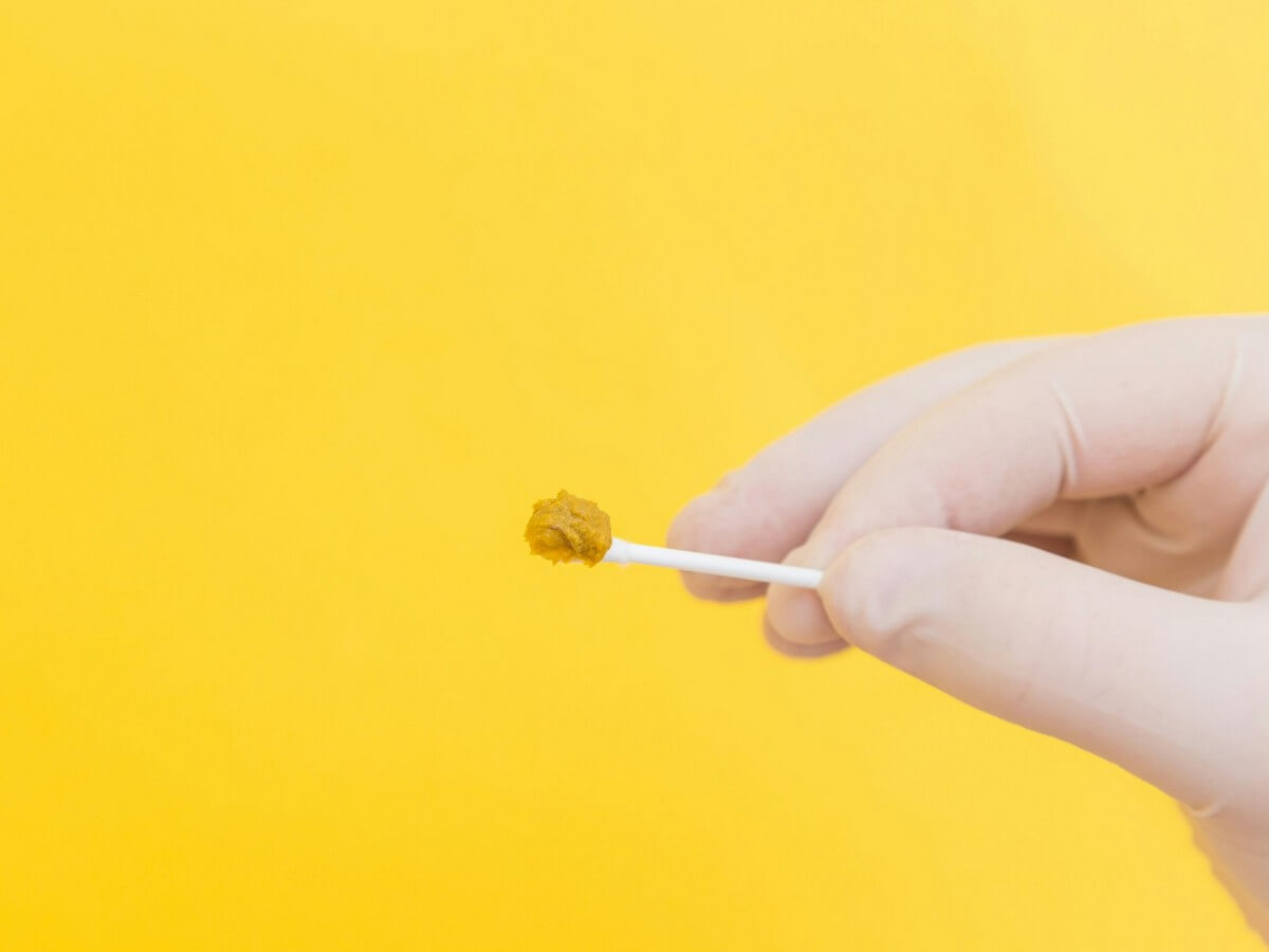 Stool Test for Ova and Parasites (O&P)