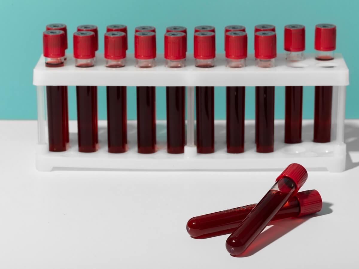 Sequence of Filling of Tubes for Hematological Investigations