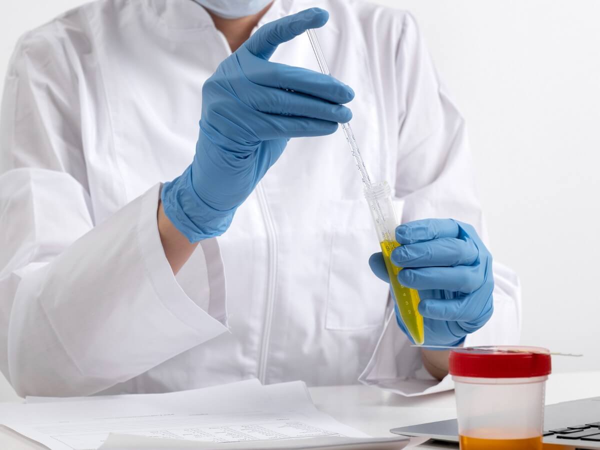 Sulphosalicylic Acid Test for Proteinuria: Principle, Procedure, and ...