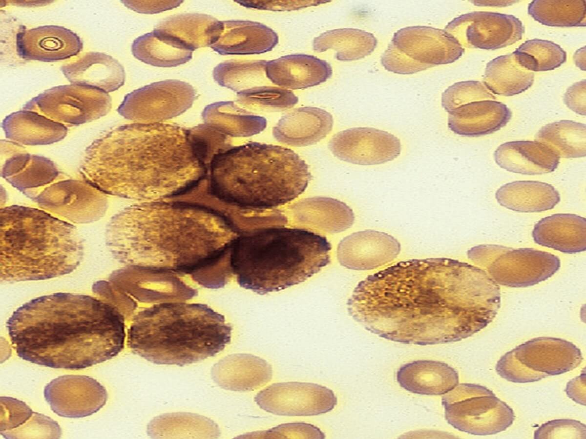 Myeloperoxidase (MPO) Stain: Purpose, Principle, Procedure, and ...