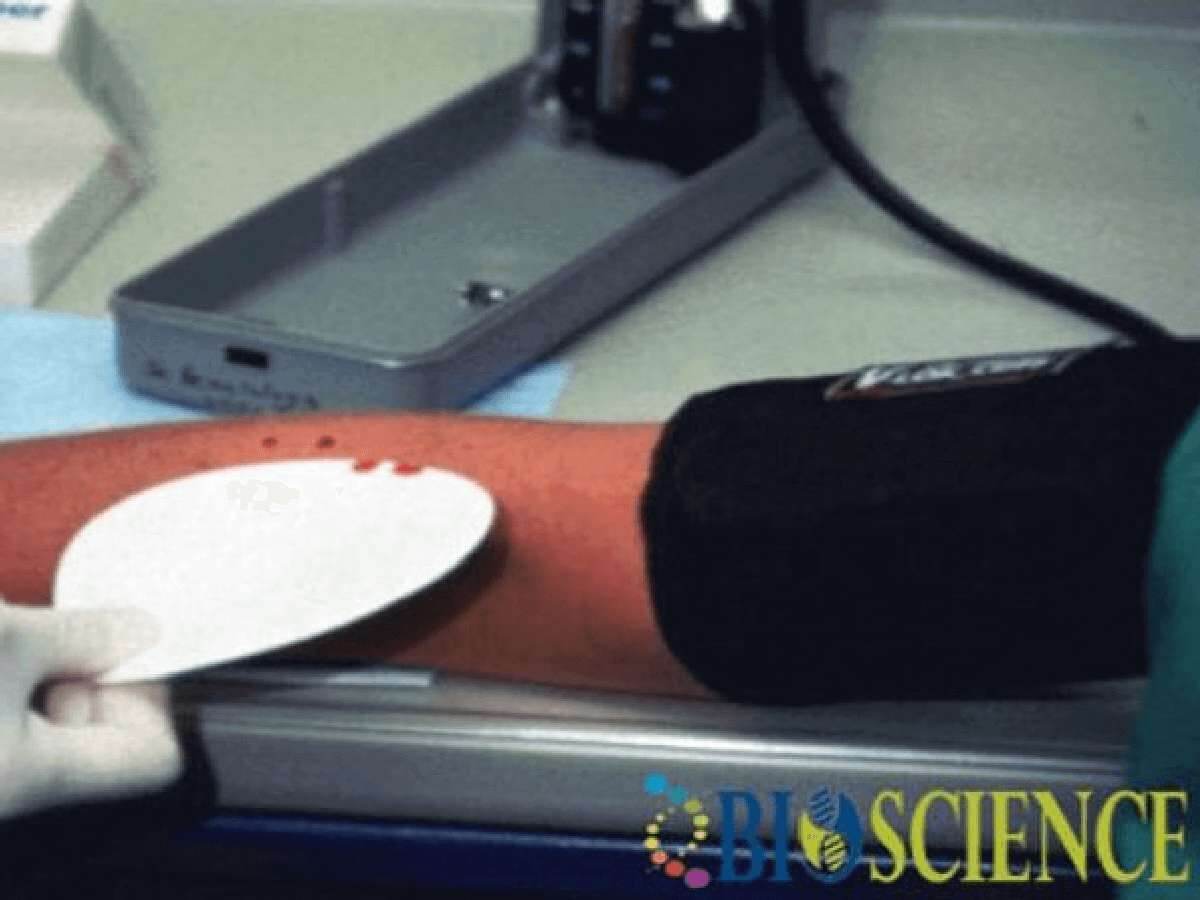 BT CT Test: Purpose, Principle, Procedure, and Interpretation